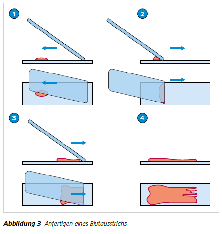 Aktuelle Themen rund um das Mikroskop - Mikroskopische Blutuntersuchung